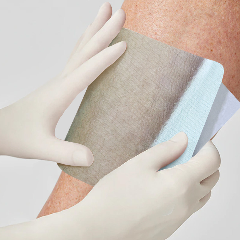 Hydrogel Dressing - Conkote